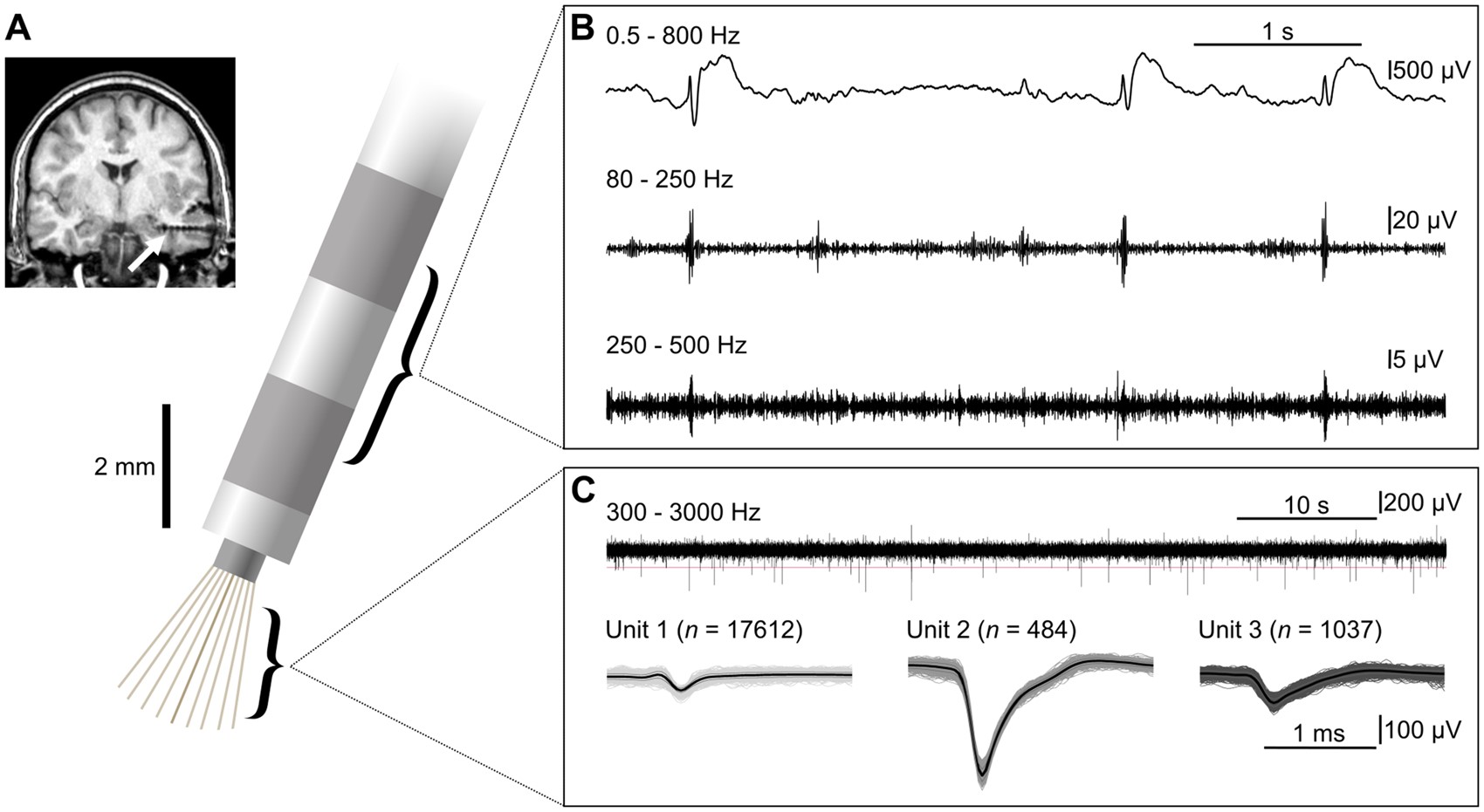 Interictal spikes with and without high-frequency oscillation have ...